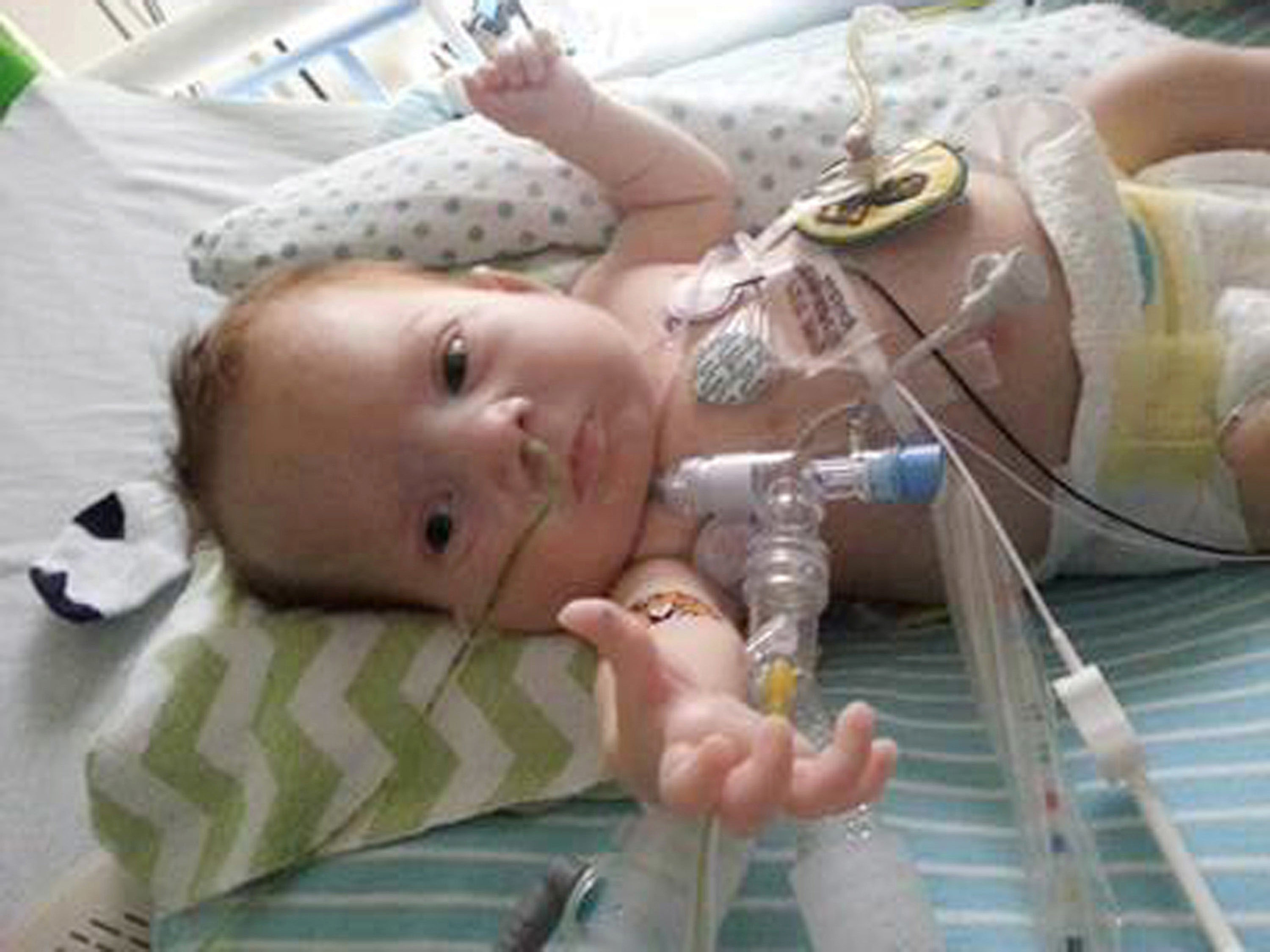 Severe birth defects not as lethal as docs once said: Study - The ...